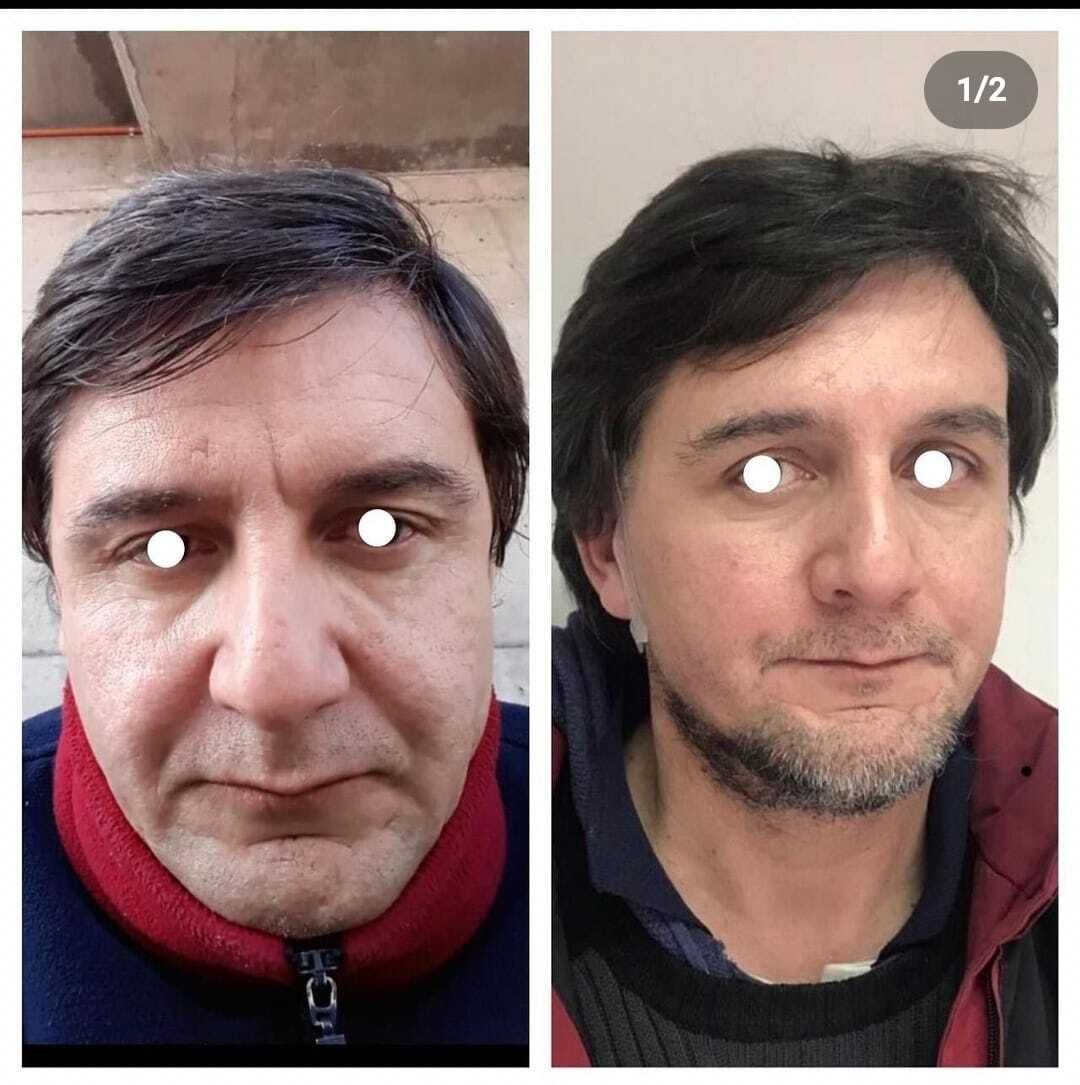 Dr. Brian Frick - Clinicasesteticas.cl