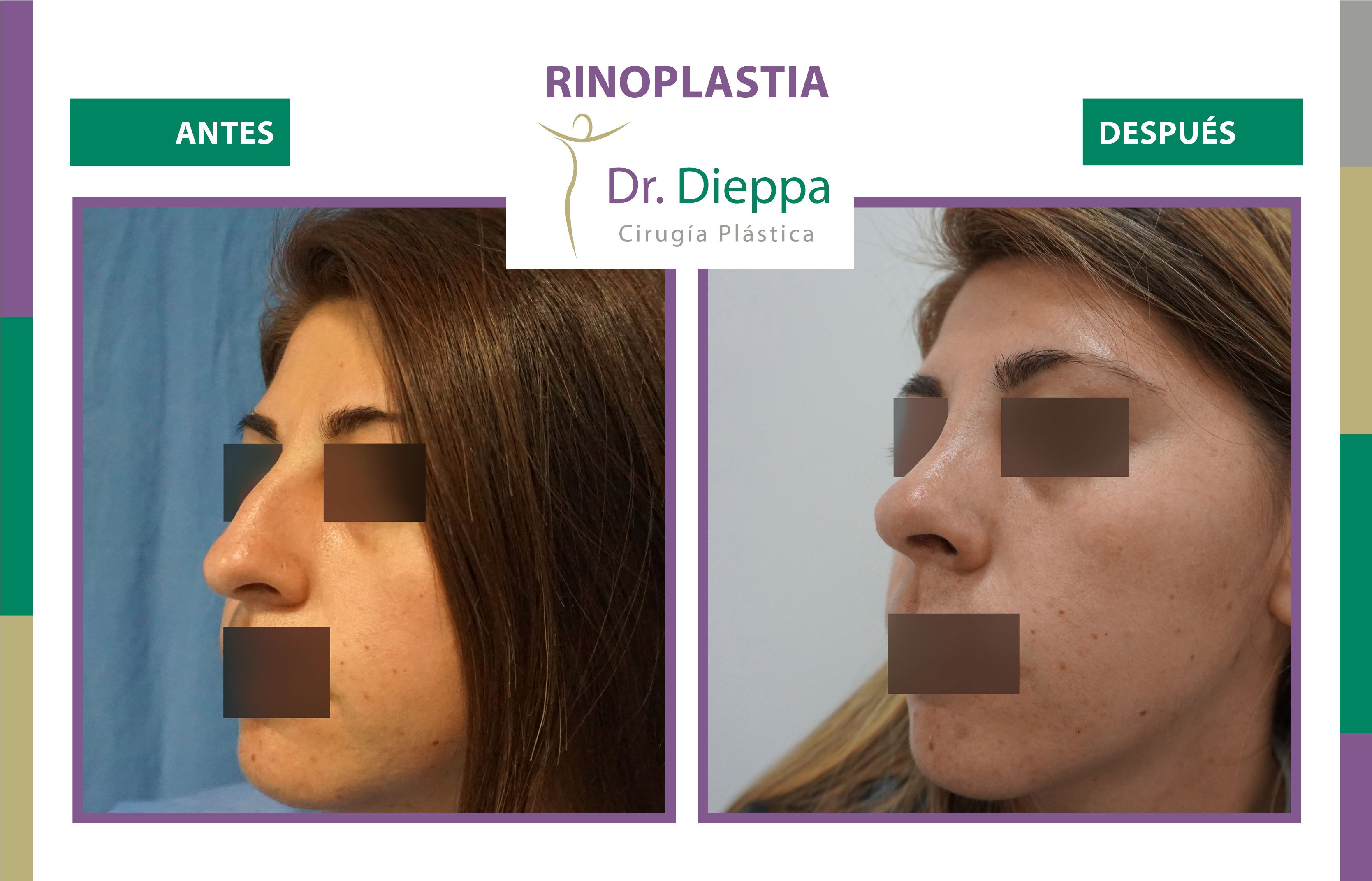Cirugía Plástica Dieppa - Clinicasesteticas.cl