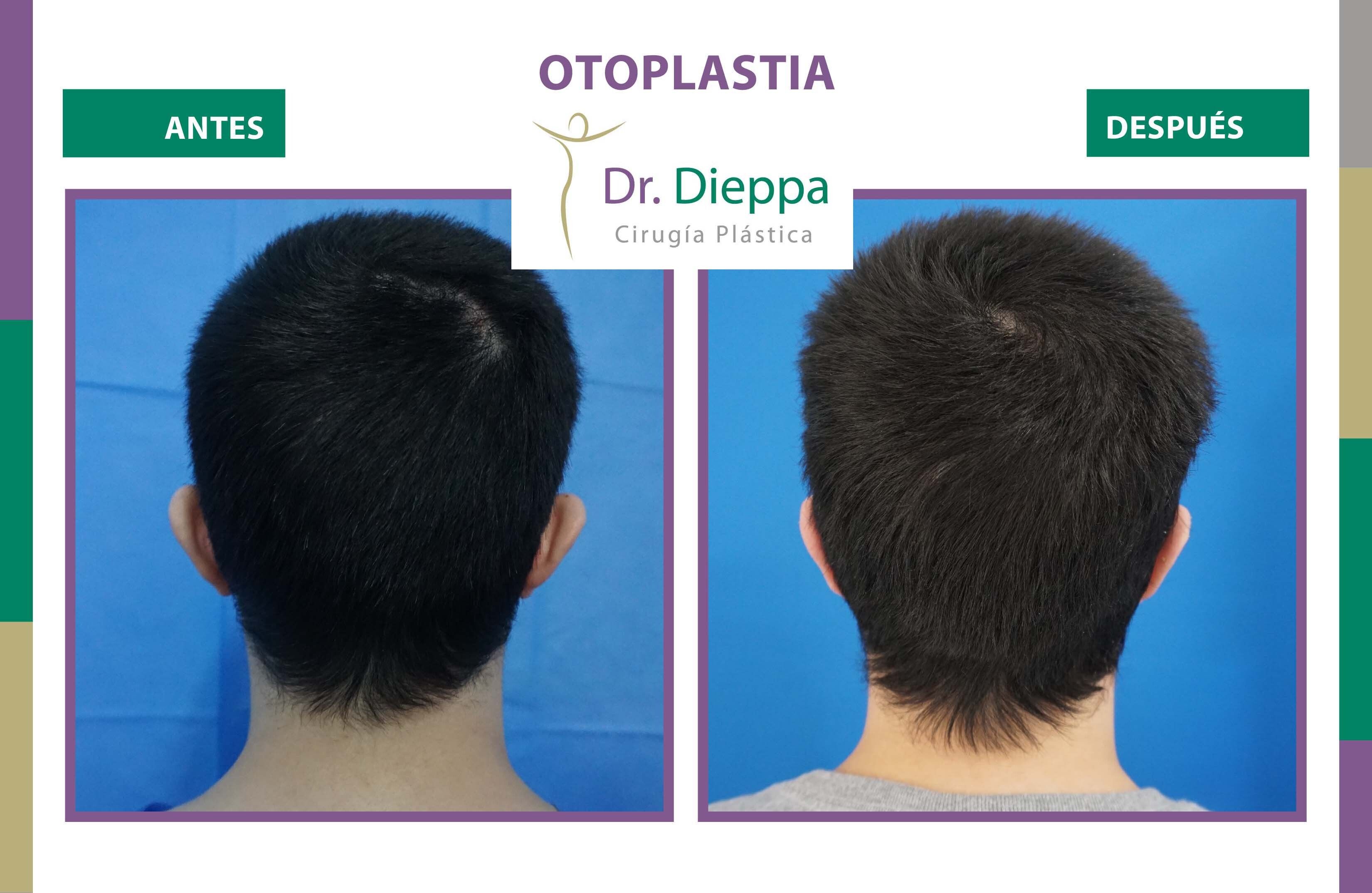 Cirugía Plástica Dieppa - Clinicasesteticas.cl