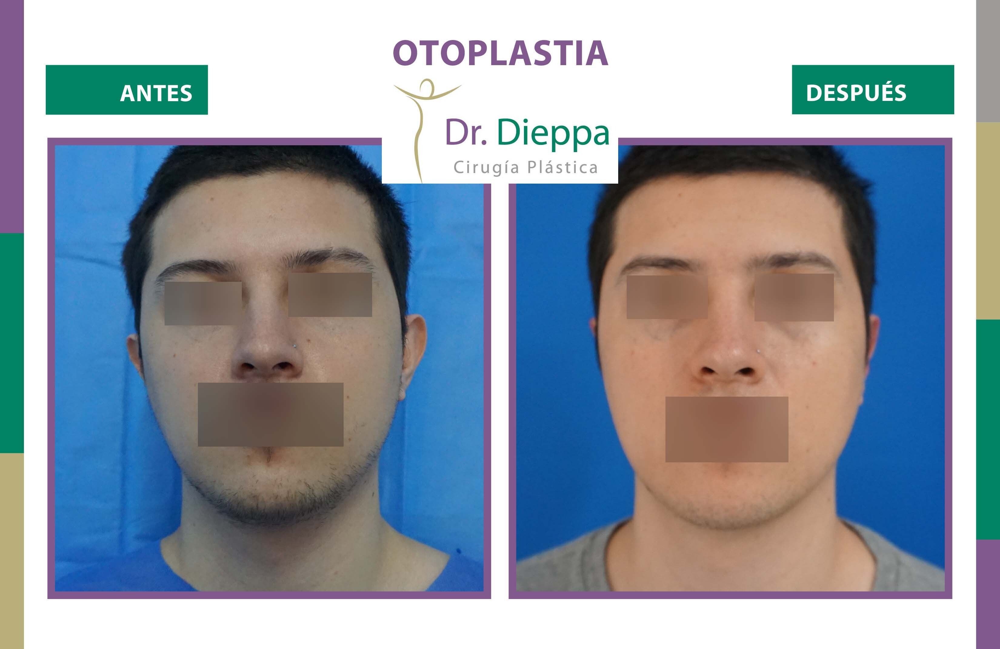 Cirugía Plástica Dieppa - Clinicasesteticas.cl