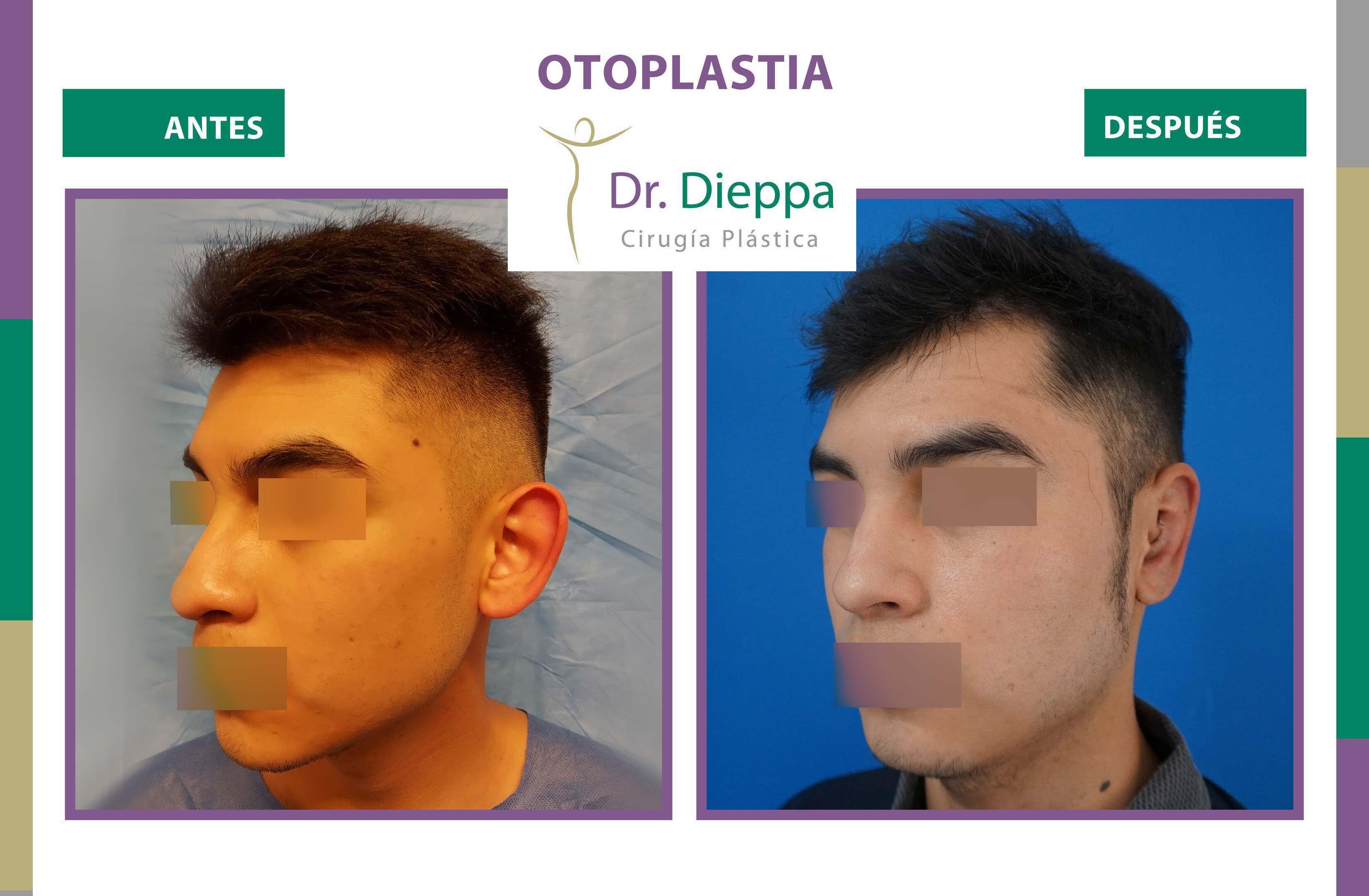 Cirugía Plástica Dieppa - Clinicasesteticas.cl