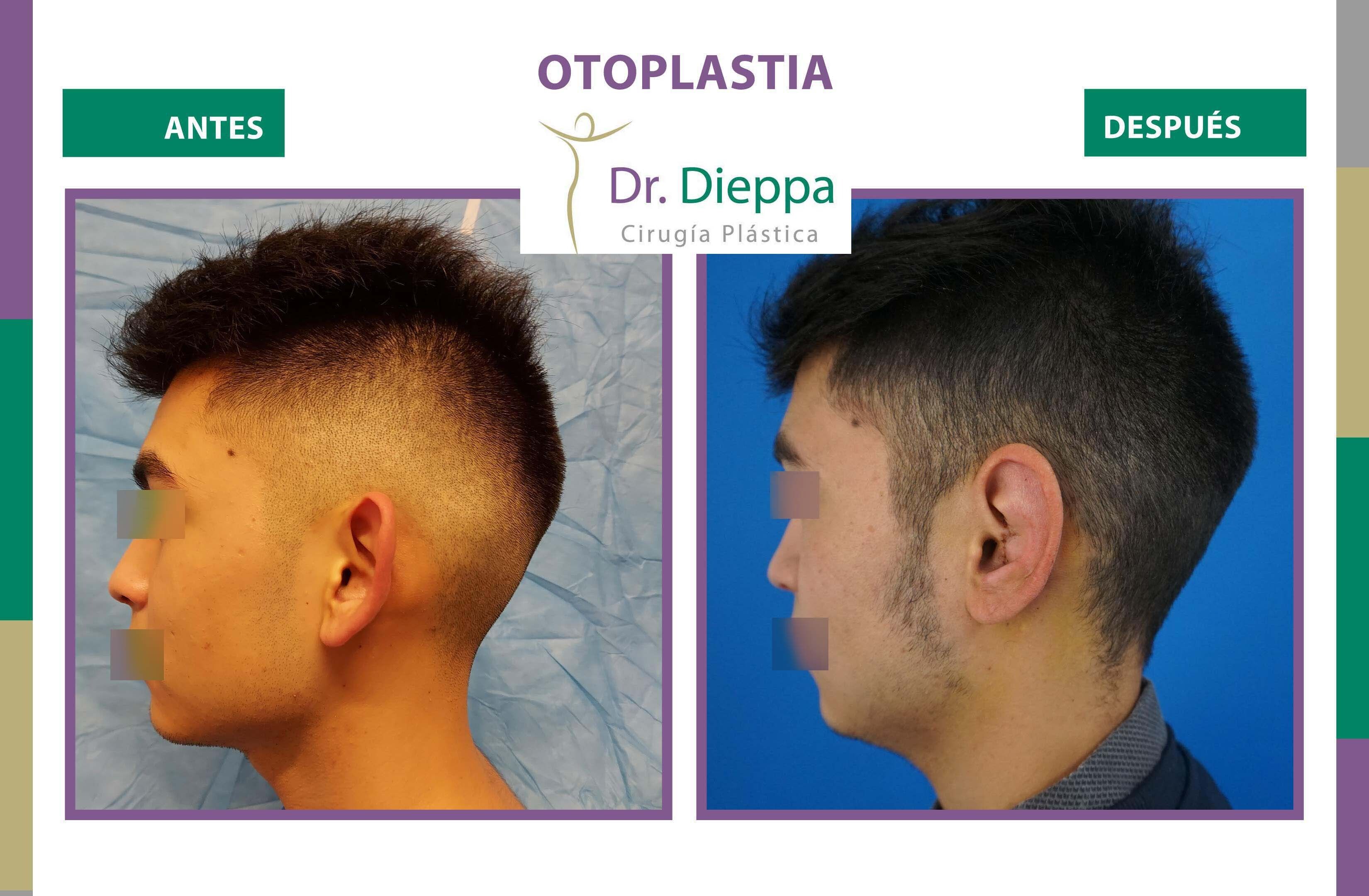 Cirugía Plástica Dieppa - Clinicasesteticas.cl