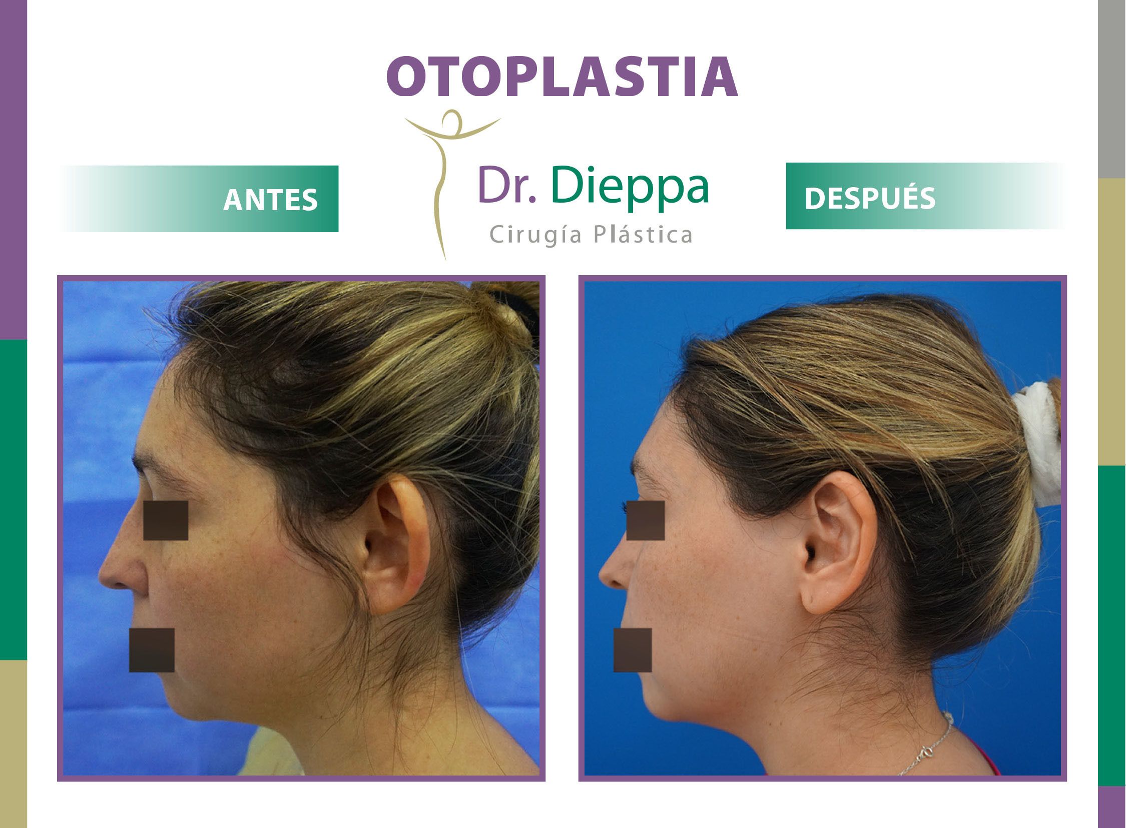 Cirugía Plástica Dieppa - Clinicasesteticas.cl