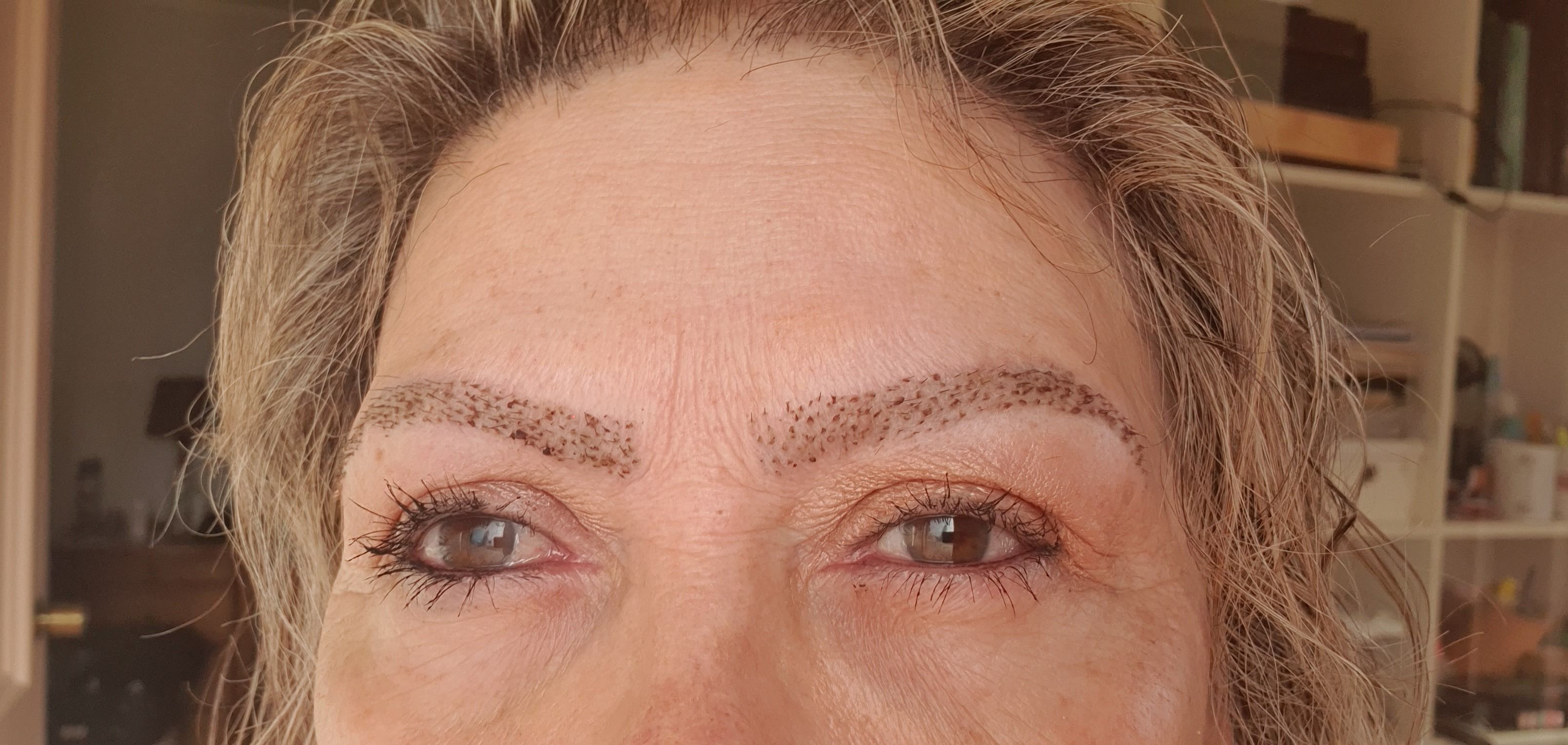 Implante de Cejas después de microblading - Implante Capilar ...